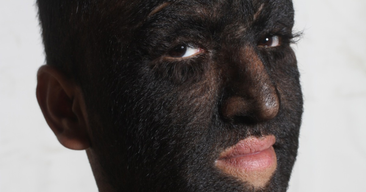 Strange Medical Conditions You Won’t Believe Are Real - HealthPrep.com