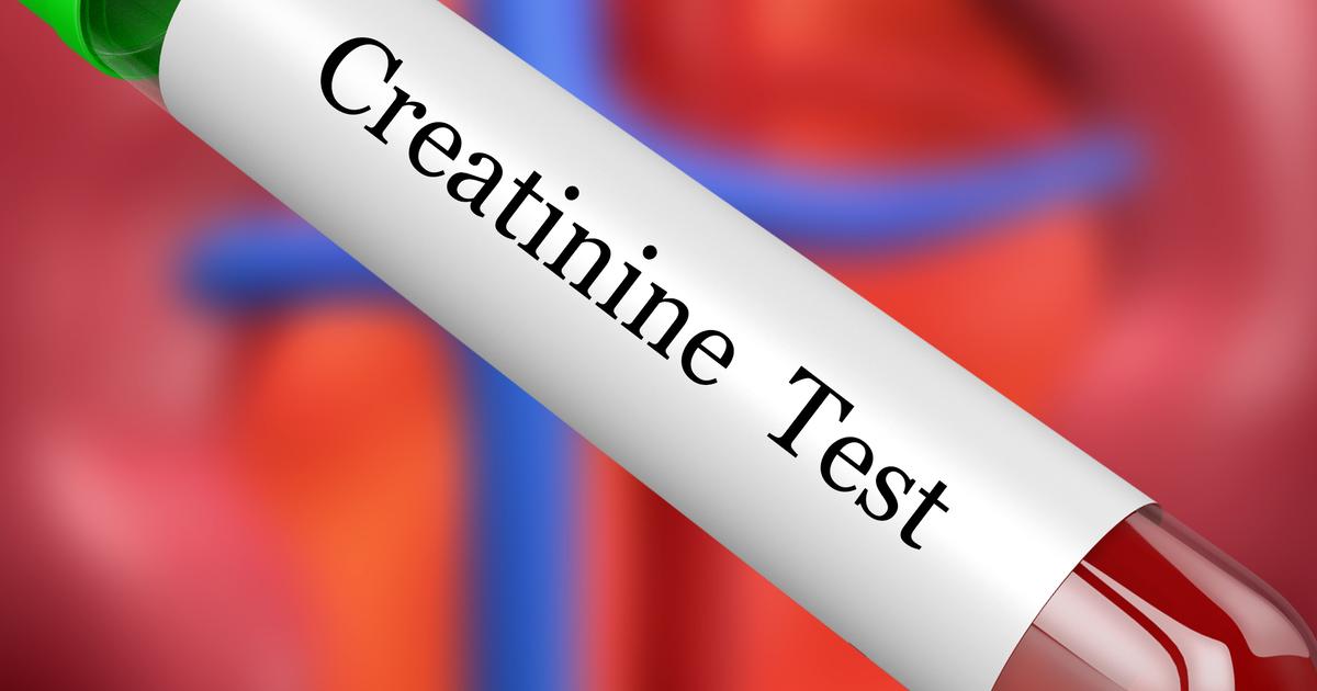 What Is A Creatinine Test? - HealthPrep.com