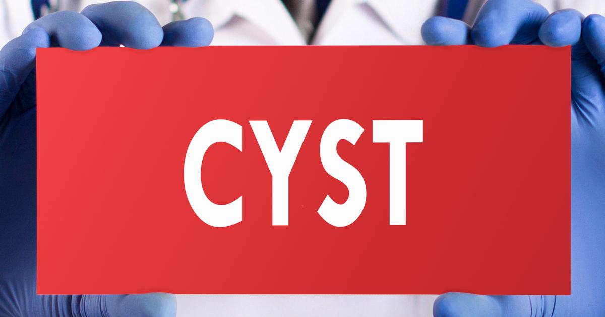 Guide To The Common Types Of Cysts - HealthPrep.com