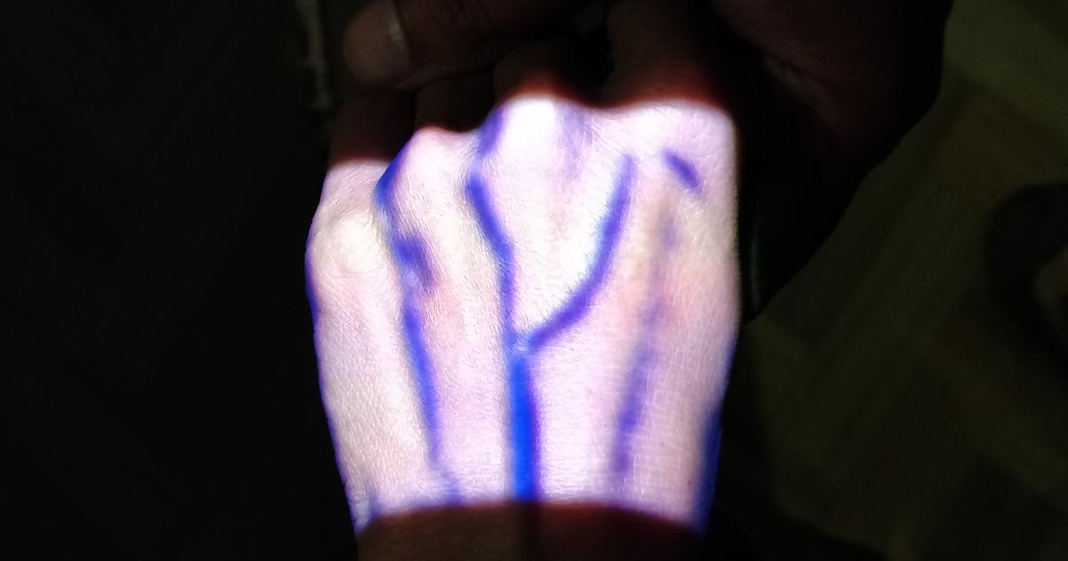 What Are The Types Of Veins? - HealthPrep.com