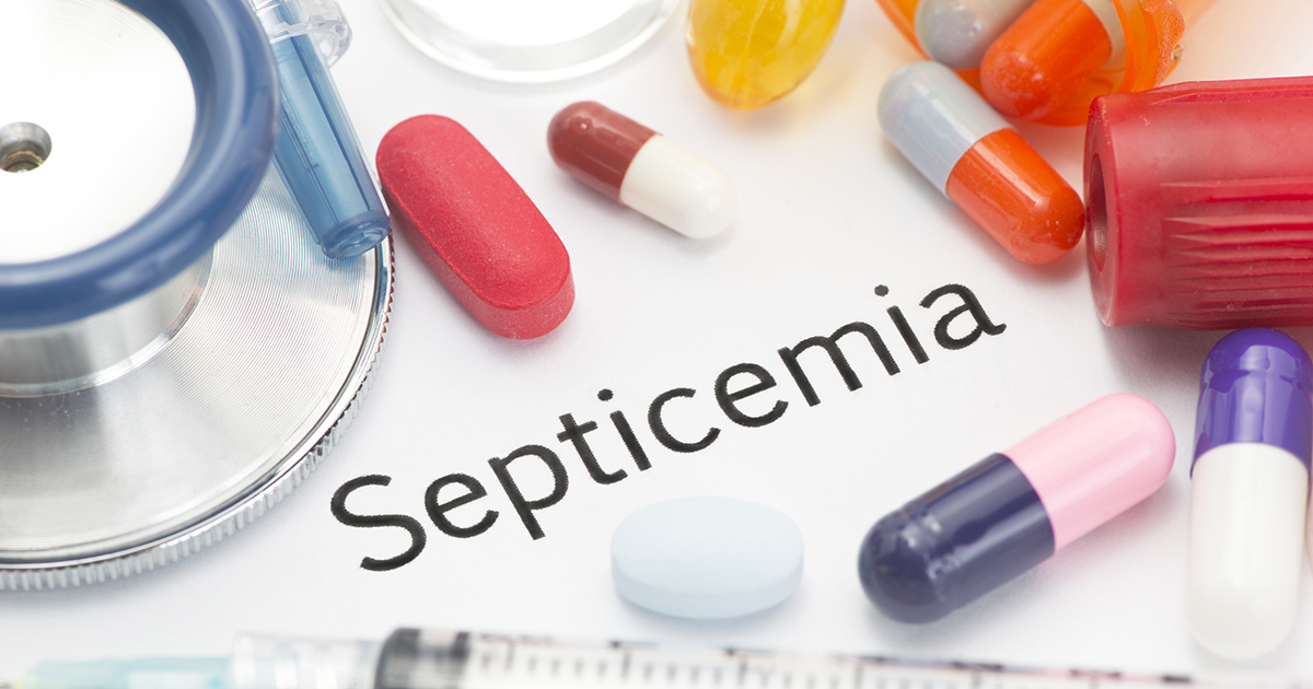 Causes And Risk Factors Of Septicemia - HealthierHer.com