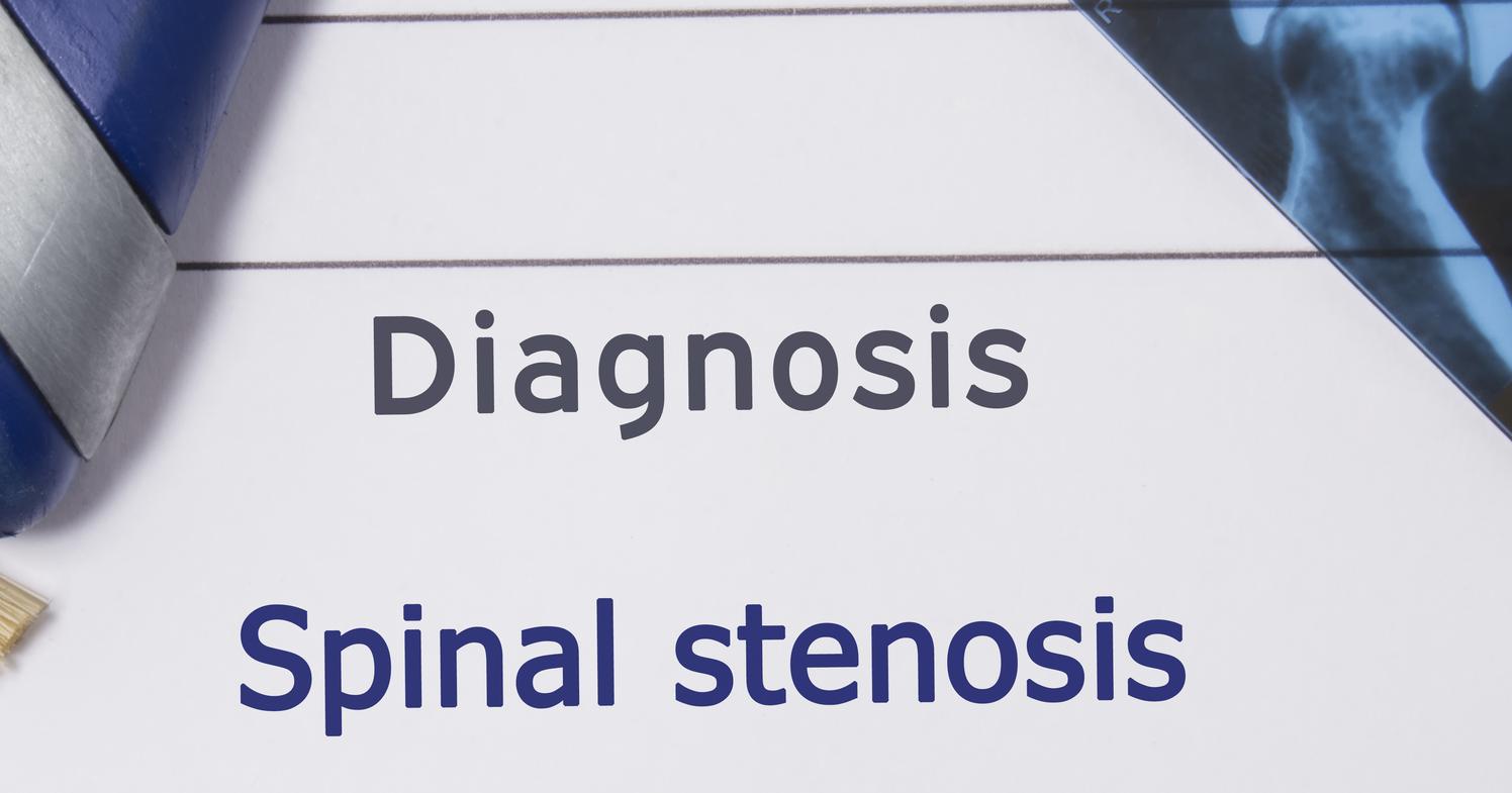 Warning Signs Of Spinal Stenosis Healthierher