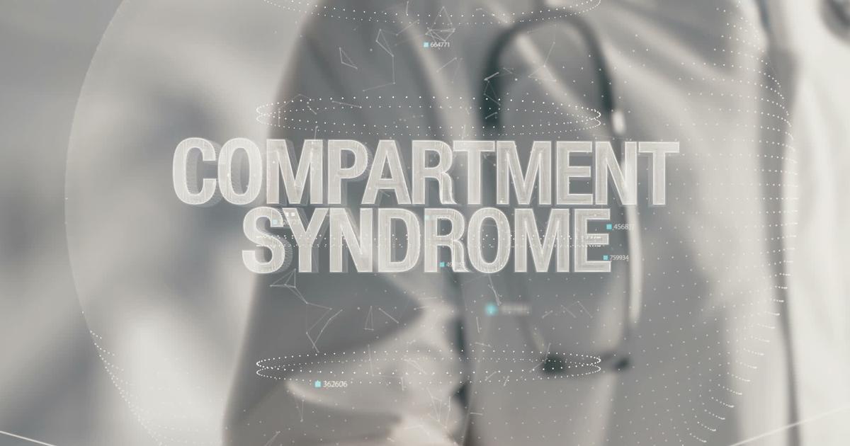 How To Diagnose And Treat Compartment Syndrome - HealthierHer.com