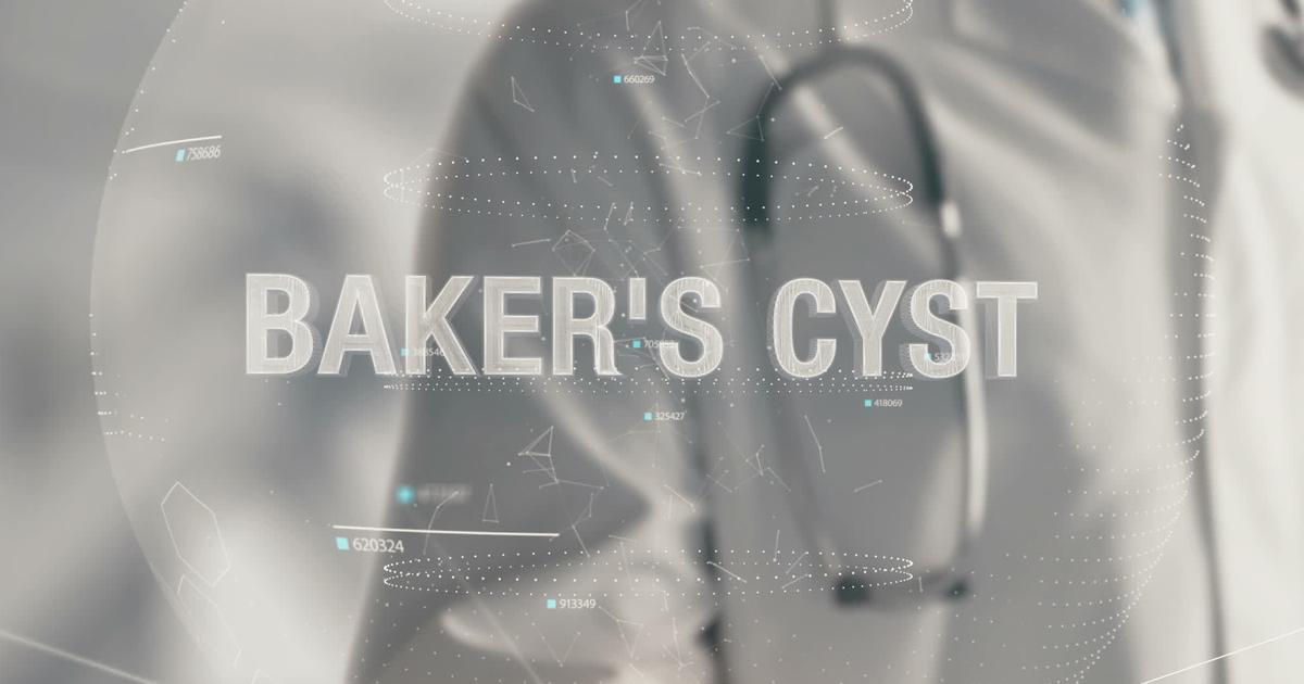 Strategies For Treating A Baker's Cyst - HealthierHer.com
