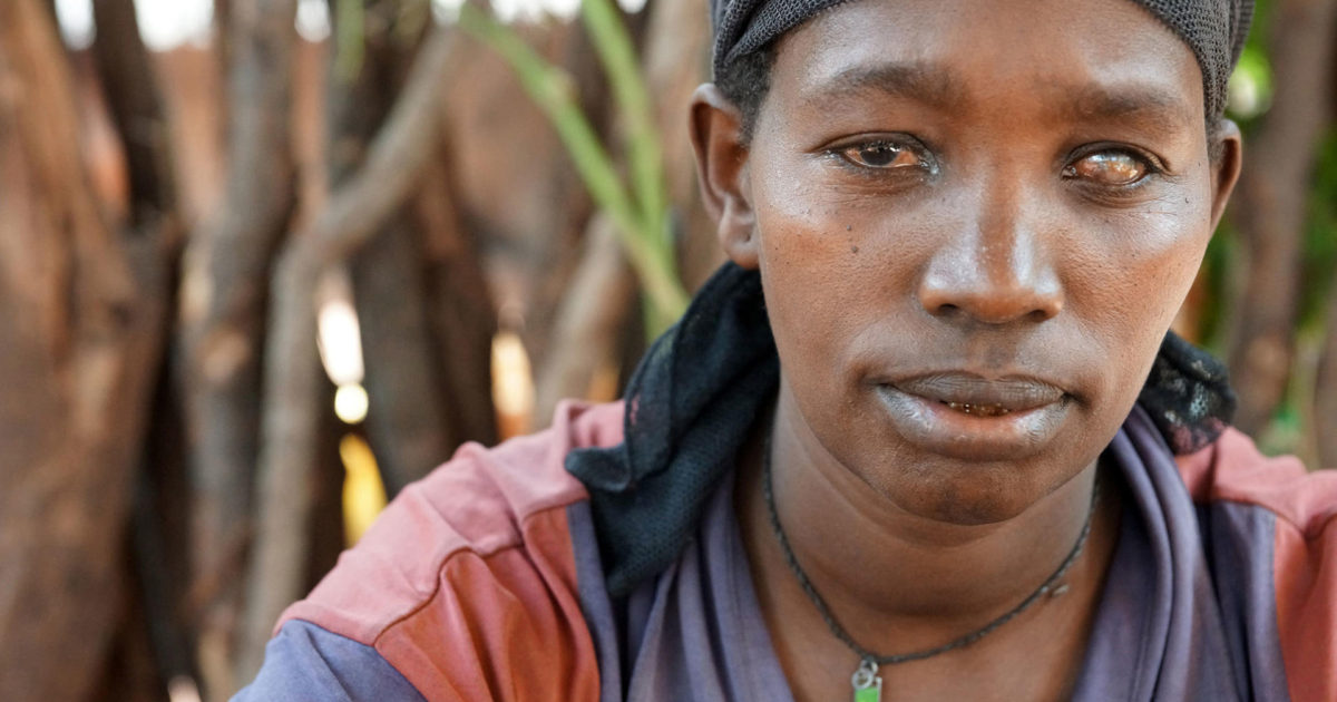 Symptoms And Progression Of Trachoma - HealthierHer.com