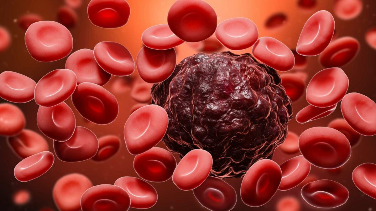 Types Of Blood Cancer - Leukemia and Lymphoma - WellnessRead.com